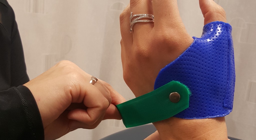 What is hand therapy?